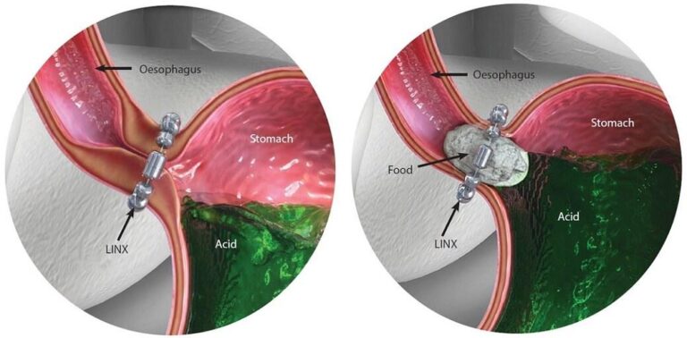 Ethicon | Surgical Innovation For Improved Patient Outcomes | Patient9
