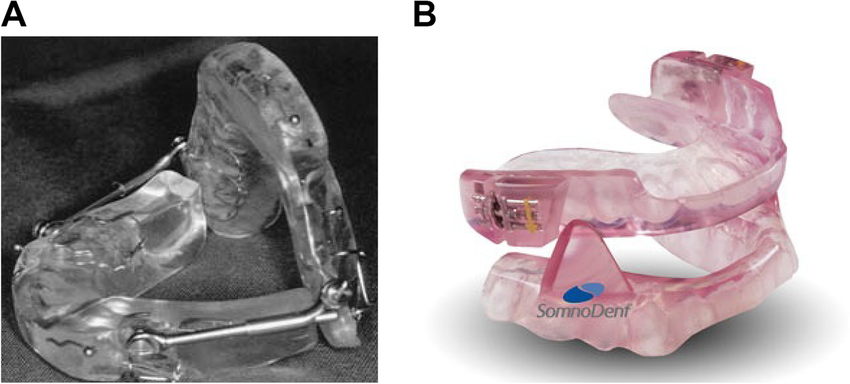 Mandibular Advancement Devices - Medical Device Registry